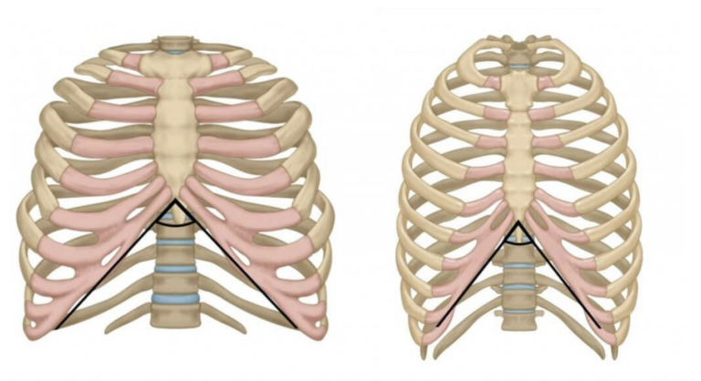 Wider Ribs After Pregnancy? 5 Exercises To Fix Rib Flare - liftwithemily.com